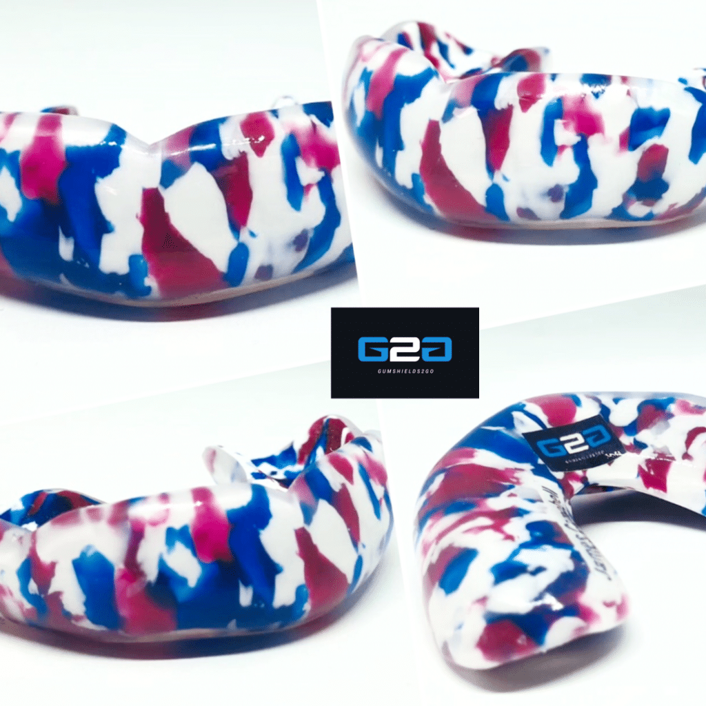 DIY HOME IMPRESSION KIT - Gumshields2Go